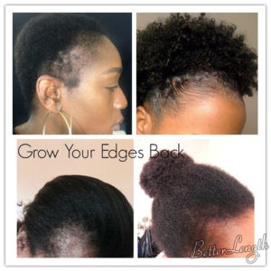 5 TIPS to Make Your Edges Thriving | BetterLength Hair